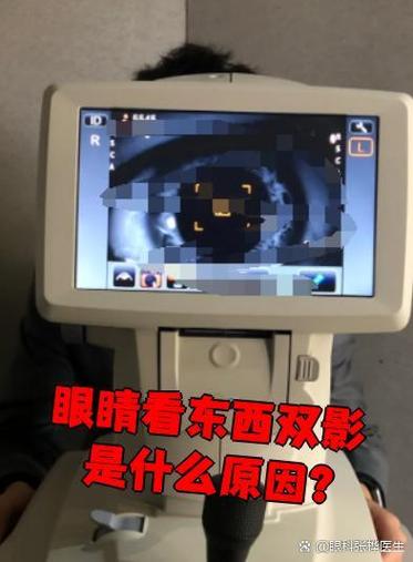 看电视双影怎么回事图标