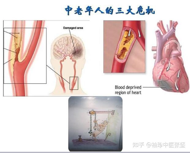 性功能强的人长寿吗截图