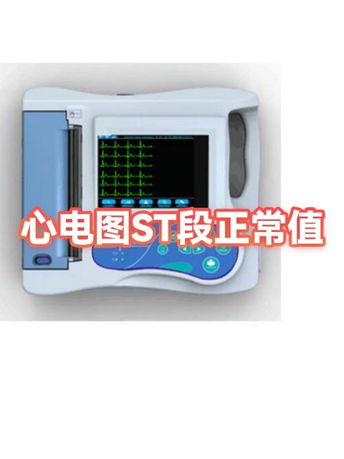 心电图正常值范围图标