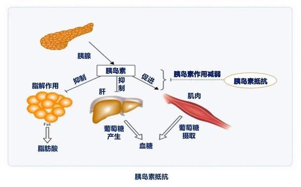 什么叫做胰岛素抵抗截图