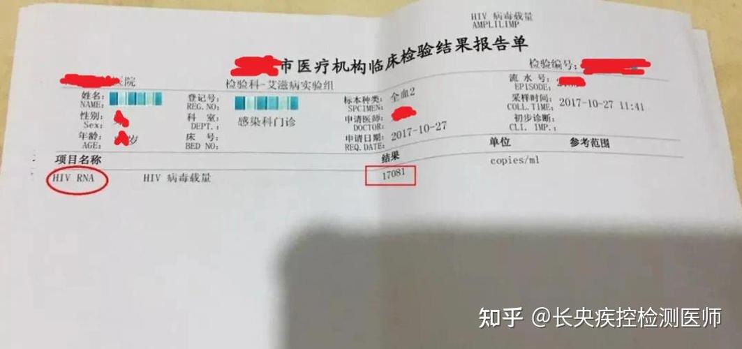 hiv核酸检测准确率图标