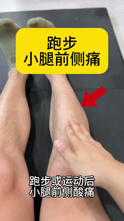 小腿肌肉酸痛图标