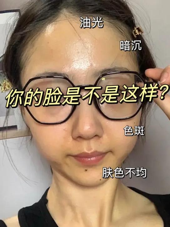 肤色暗黄怎么改善