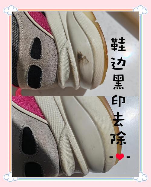 鞋子黑印怎么去除图标