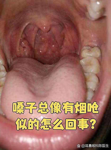 嗓子像烟呛的那种感觉图标