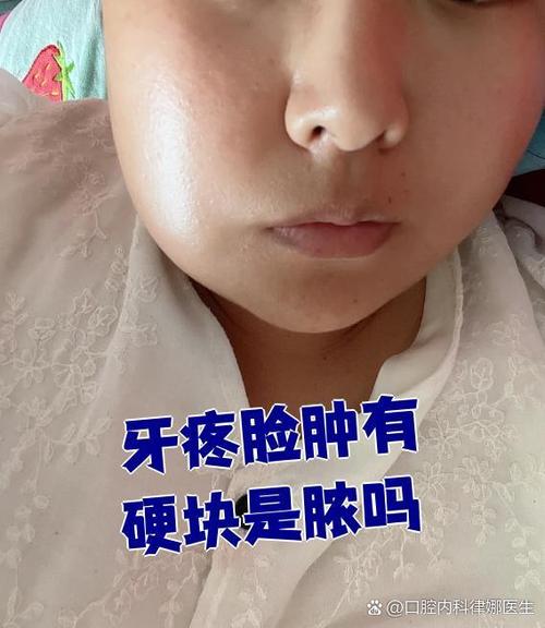 牙疼脸肿是怎么回事什么原因引起的图标