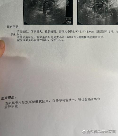 暗区两天变成孕囊截图