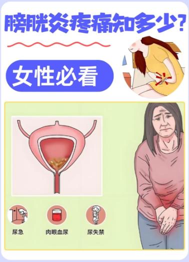 膀胱炎严重吗