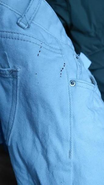男子穿衣服翻出十几只臭屁虫图标