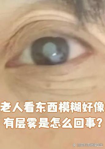 眼睛模糊像有一层雾图标
