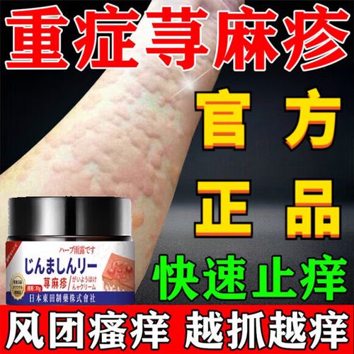 维生素d3对荨麻疹有效果吗?图标