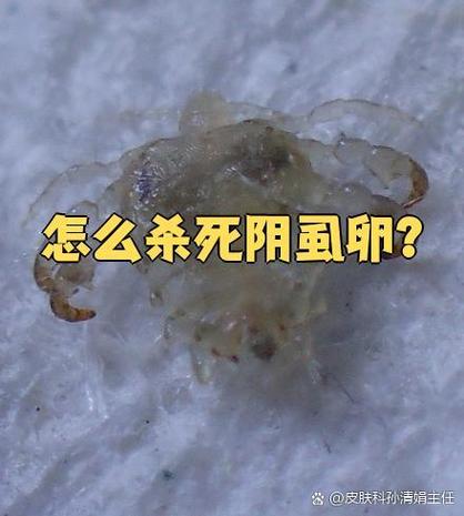 阴虱怎么处理怎么根治图标
