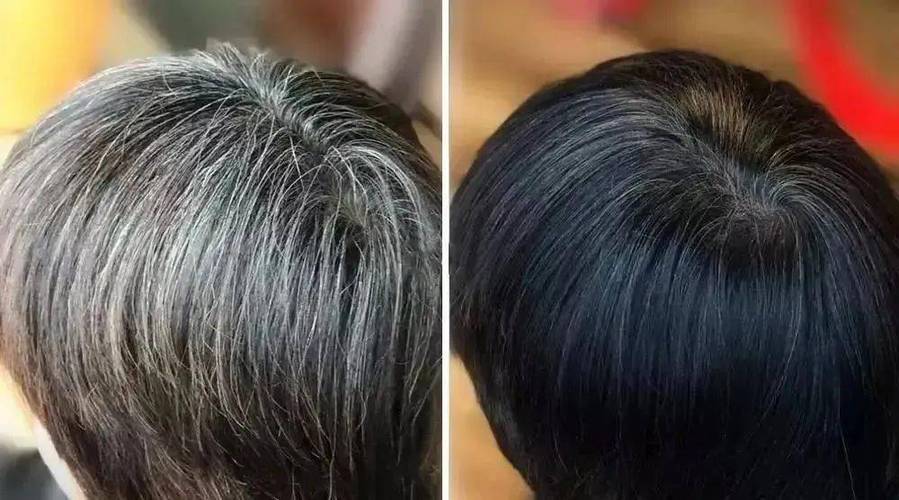 怎样防止白头发越来越多图标