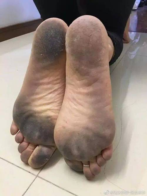 臭脚丫子有多臭图标