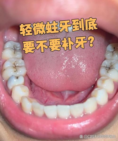 蛀牙烂掉空图图标