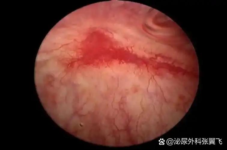 蚂蚁喜欢爬内裤图标