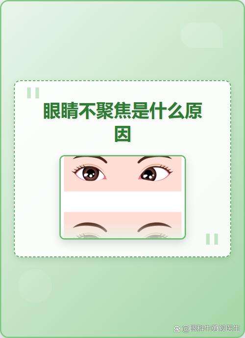 相机不聚焦是什么原因图标