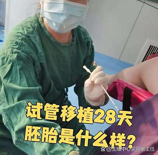 移植28天图标