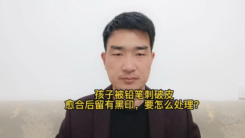 激光去除铅笔扎的黑印截图