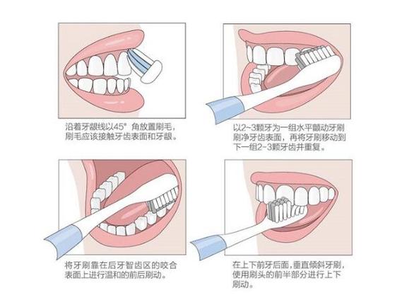 电动牙刷怎么用截图
