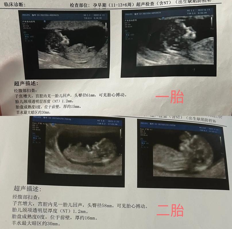 nt基础版和升级版的区别图标