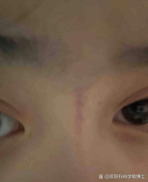 手机屏幕有一条紫色竖线图标