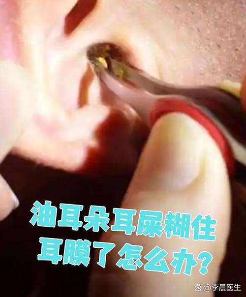 耳机油耳屎怎么清理图标