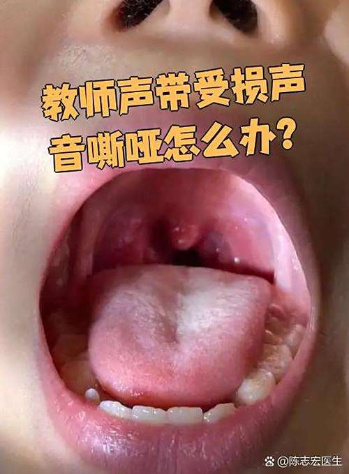 唱歌声音刺耳怎么办截图