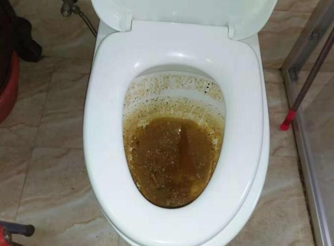 大便拉的都是水截图