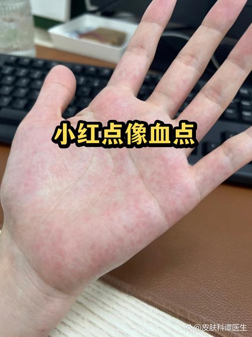 黎明杀机100w血点能升几级缩略图