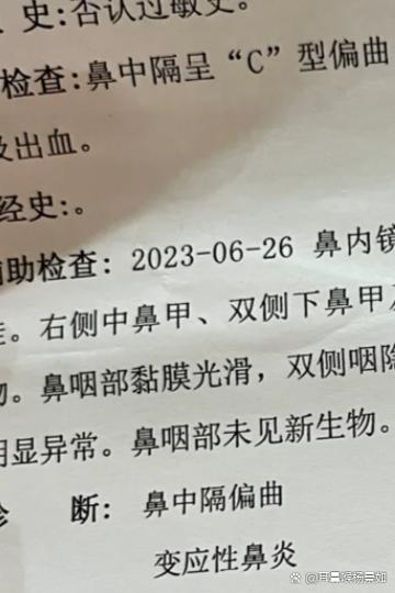 右流鼻血是什么原因引起的呢?图标