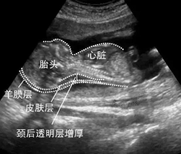 怀孕去医院检查多少钱一次图标
