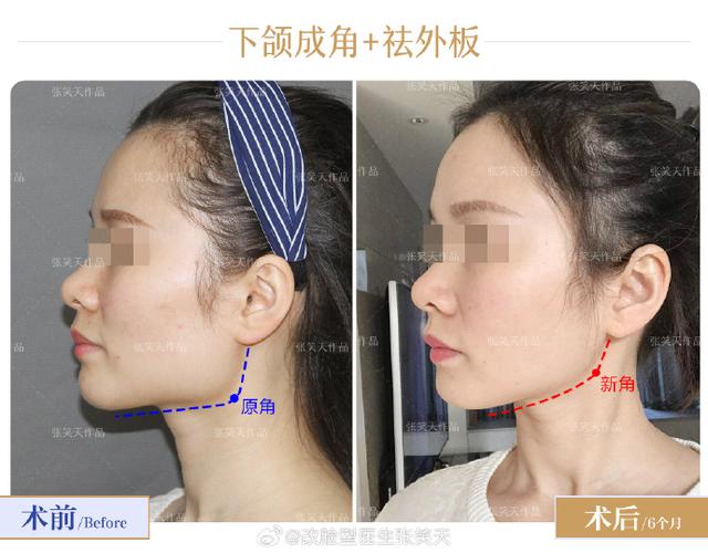 怎么让下颚线变好看图标