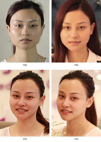 和平精英怎么修改脸型图标