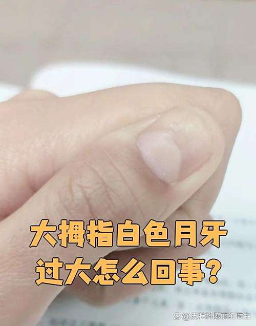 半月痕图标
