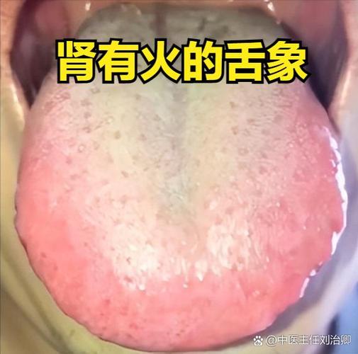 小儿口干口臭流鼻血截图