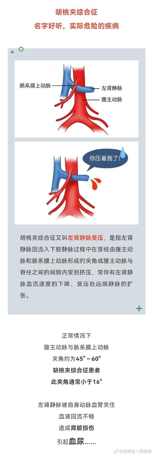 得胡桃夹的病人多吗截图