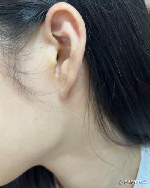 手机通话离开耳朵黑屏怎么调图标