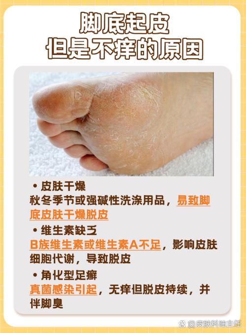 脚底板痒怎么办图标
