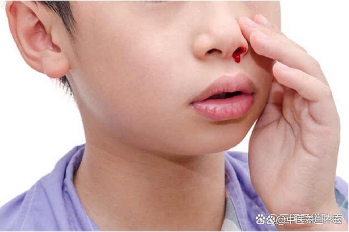 小孩上火口臭流鼻血截图