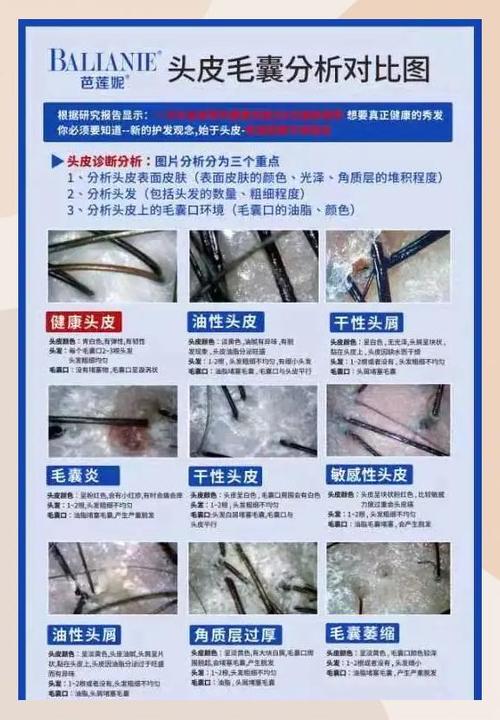 理发店做护理的步骤截图