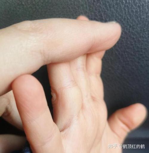 老人指纹磨没了怎么办图标