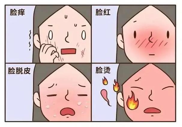 脸部一直痒是什么原因图标