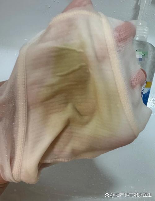 内裤总是湿漉漉的,而且发黄,有异味图标