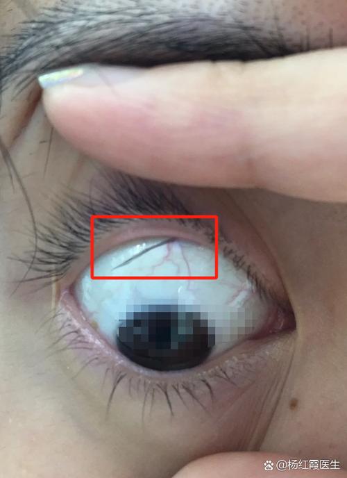 眼睛像有沙子磨的感觉图标