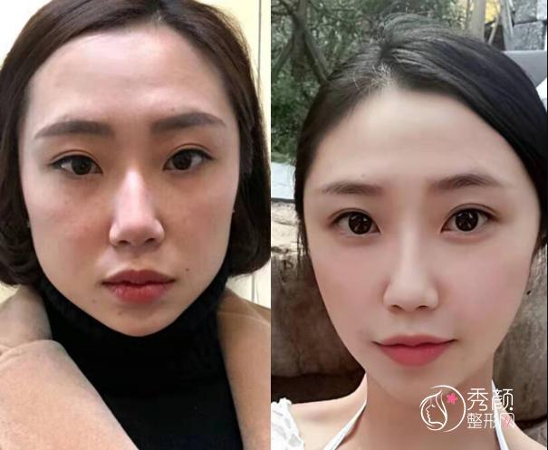 秀颜直播一对一图标