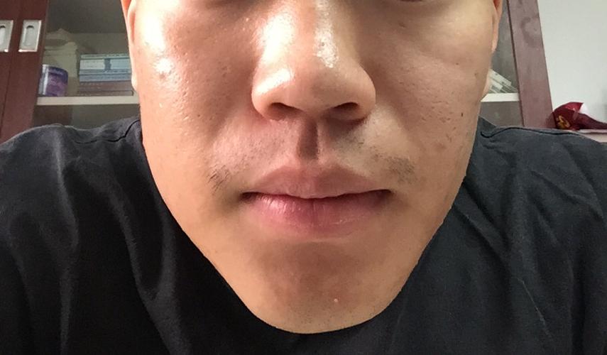 前置摄像头不能自拍了图标