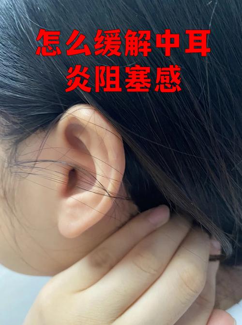 蓝牙耳机听断断续续图标