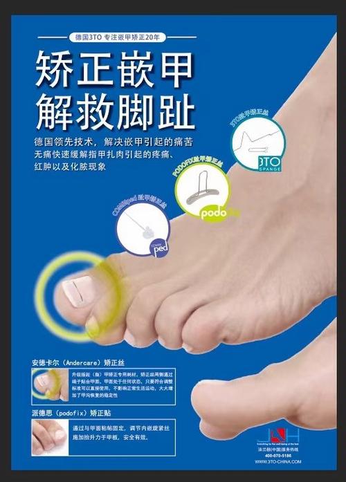 脚趾矫正器图片图标