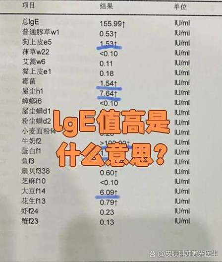 ige中文是什么意思